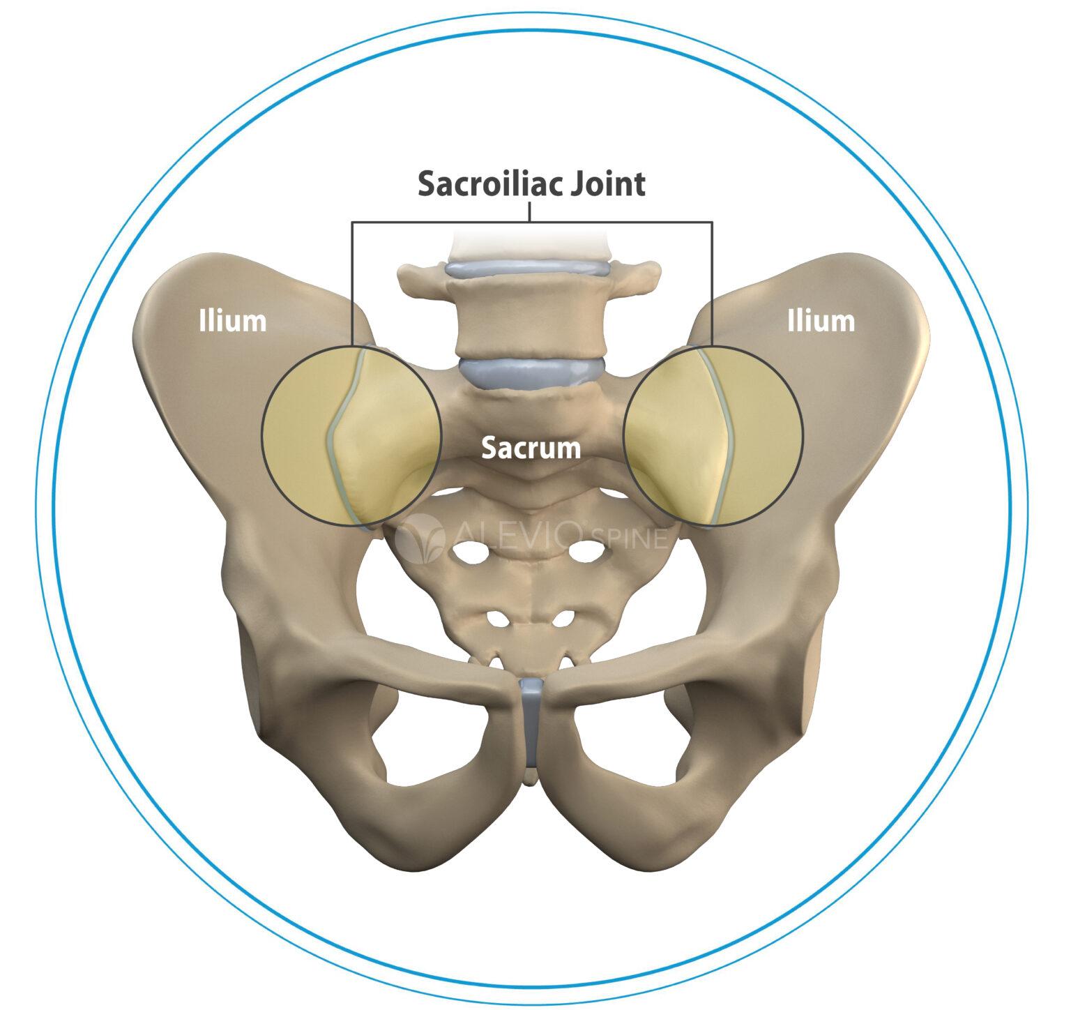 Sacroiliac Joint - Alevio Spine