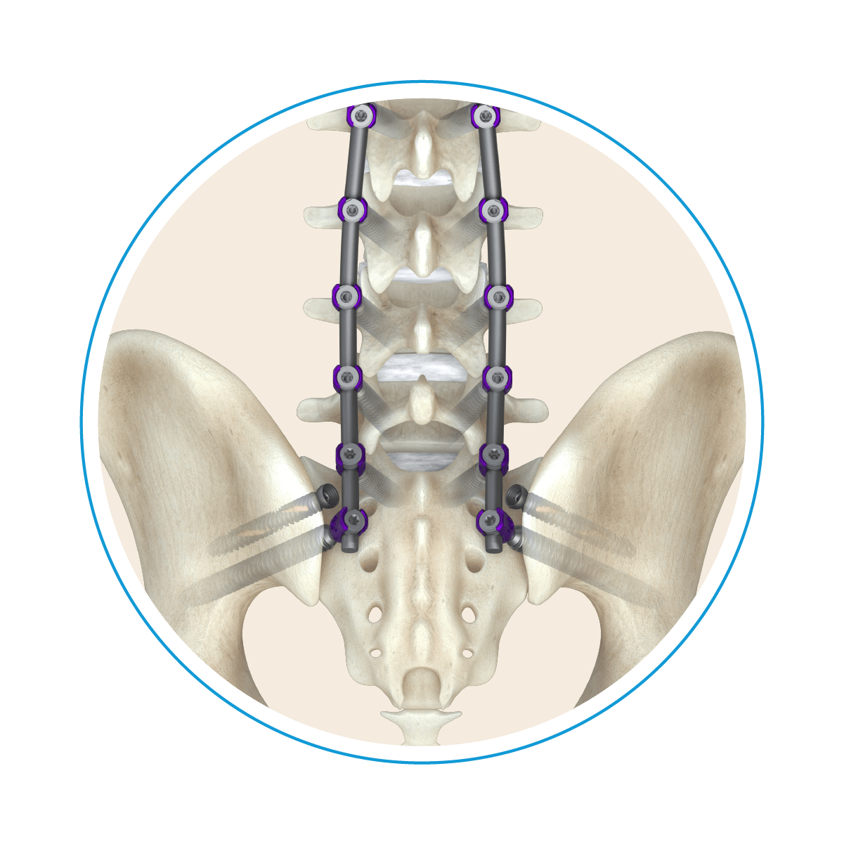 OUR PRODUCTS - Alevio Spine